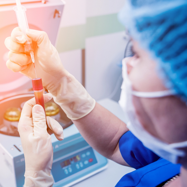 Platelet Rich Plasma - ACE UK